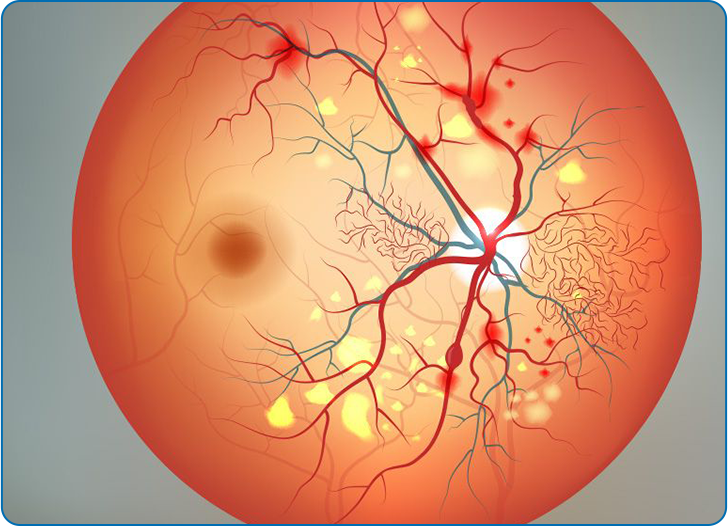 Kapoor Hospital & Eye Center